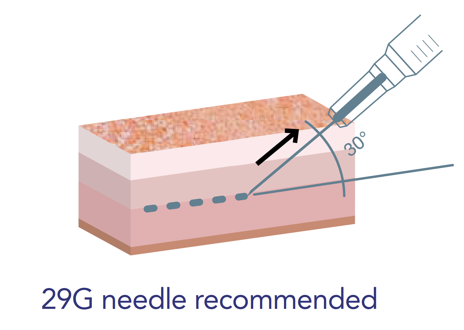 VISCODERM®Hydrobooster | IBSA Derma